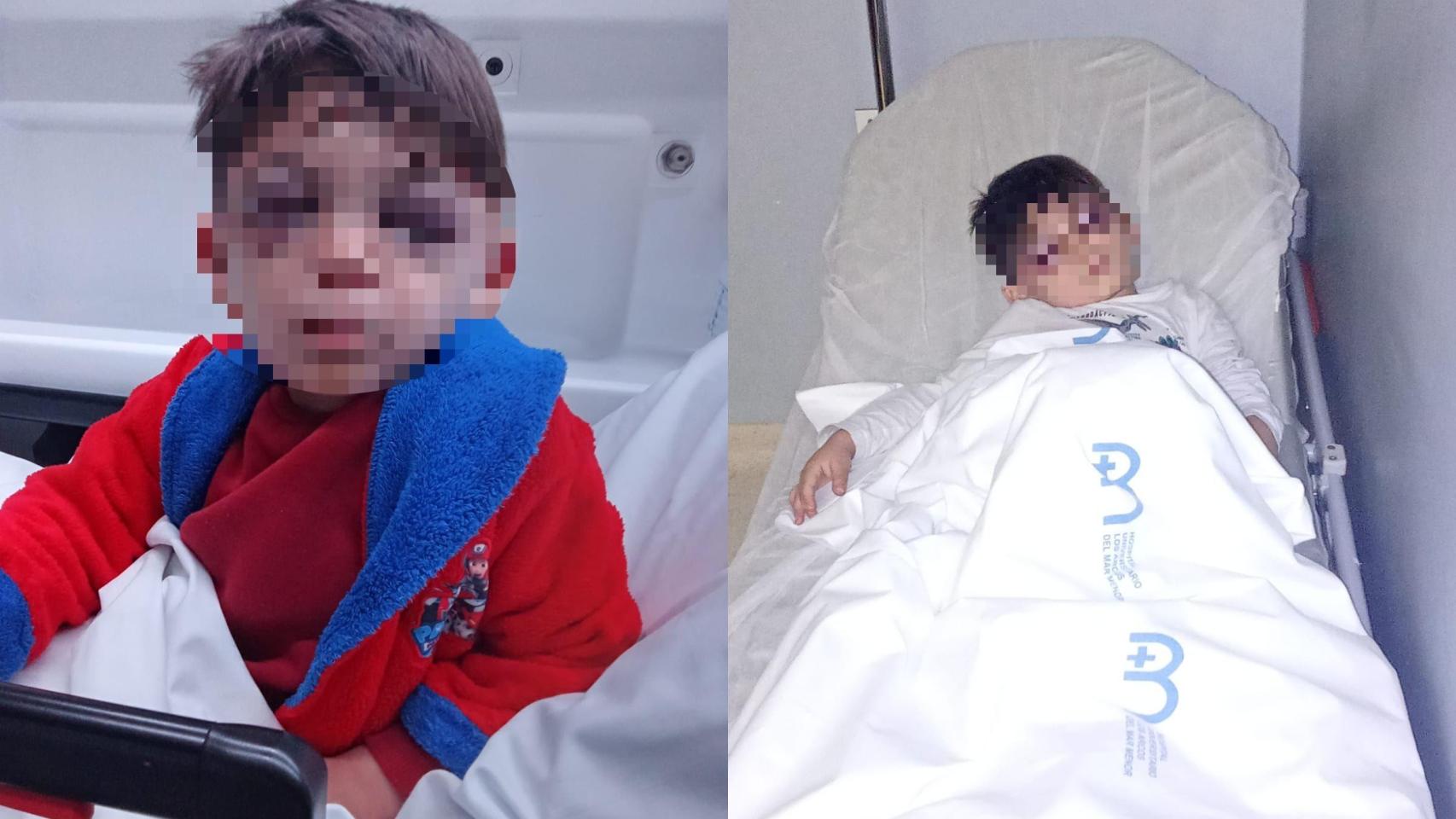 Servicios Sociales asume la tutela del niño apaleado por su padrastro ...